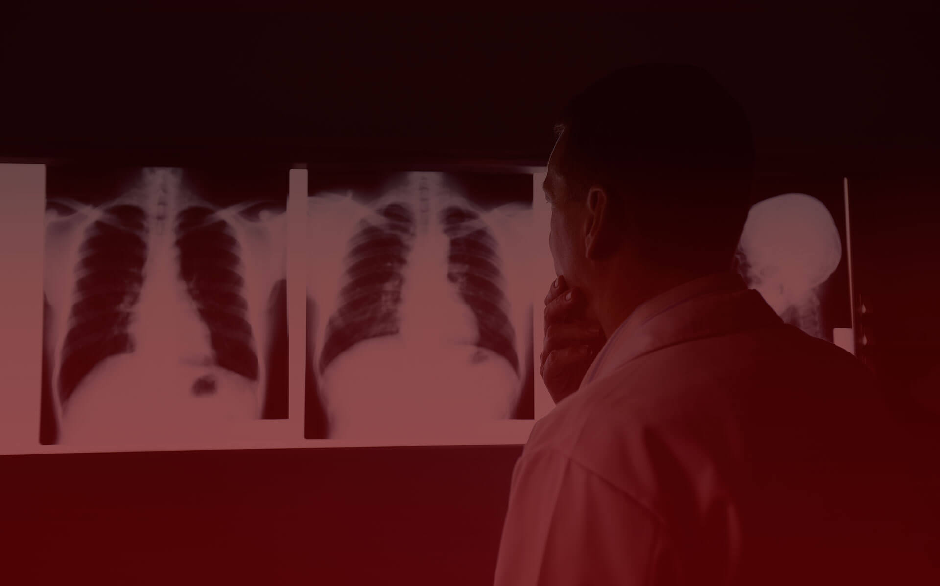 How Can Advanced Discovery Techniques Strengthen Asbestos Litigation in Fullerton? | USAttorneys.com